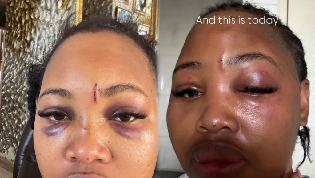 South Africans rally behind Durban GBV victim amid alleged police ...